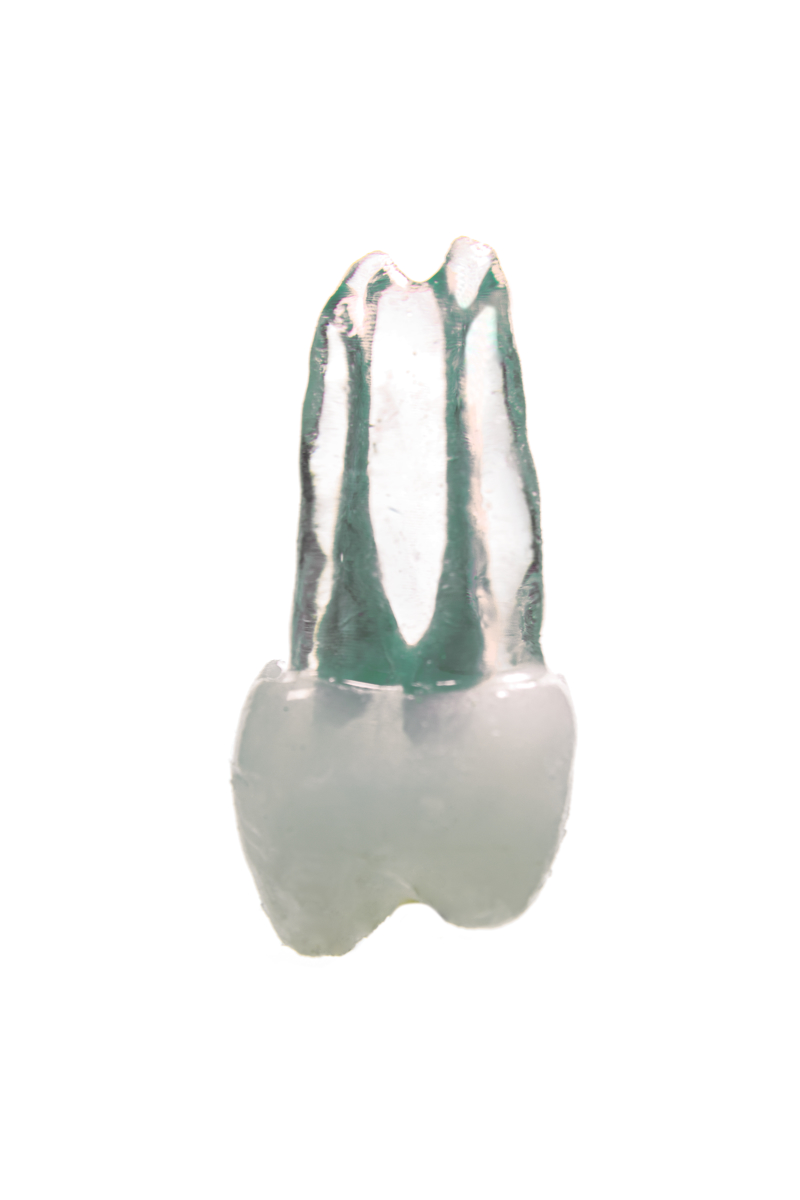 3D ROOTS TOOTH – 3D ROOTS ENDOTRAINING