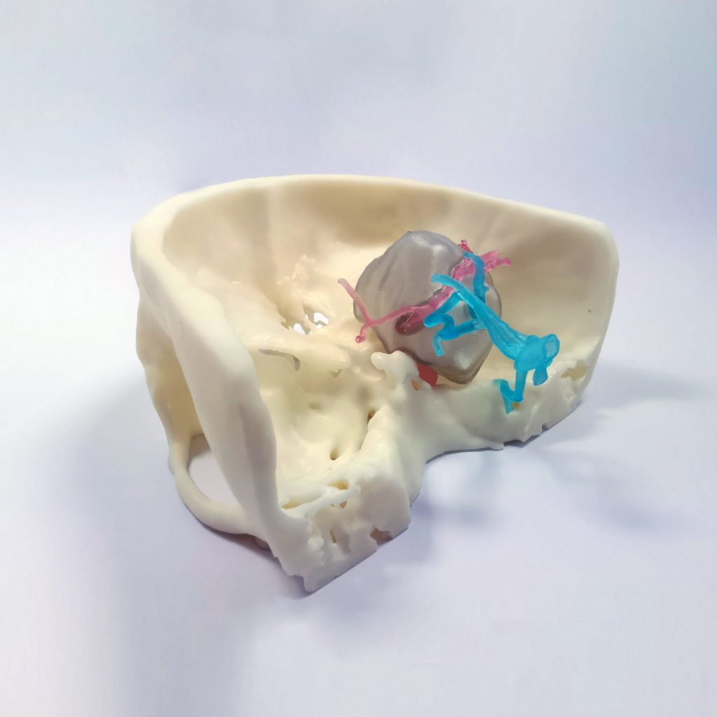 Digital Anatomics | 3D Medical printing