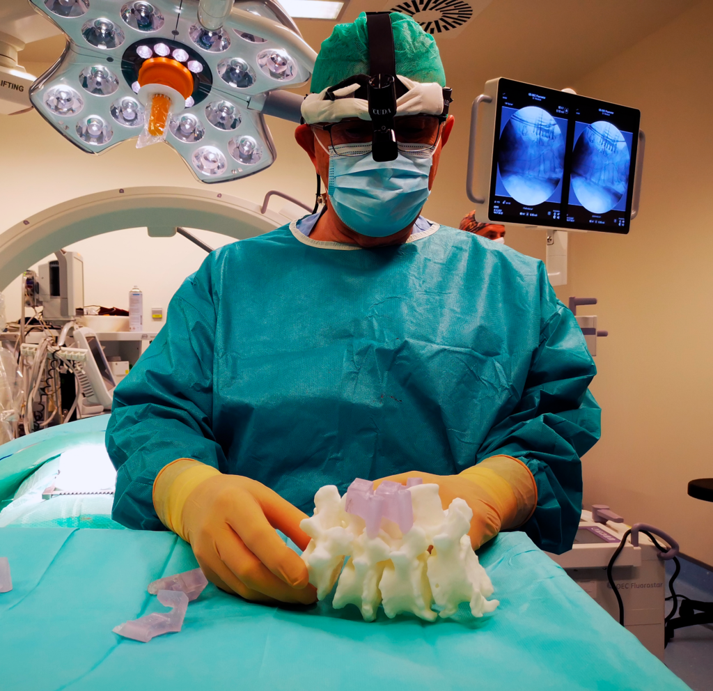 Use of surgical guides in Bertolotti syndrome. Spinal arthrodesis ...